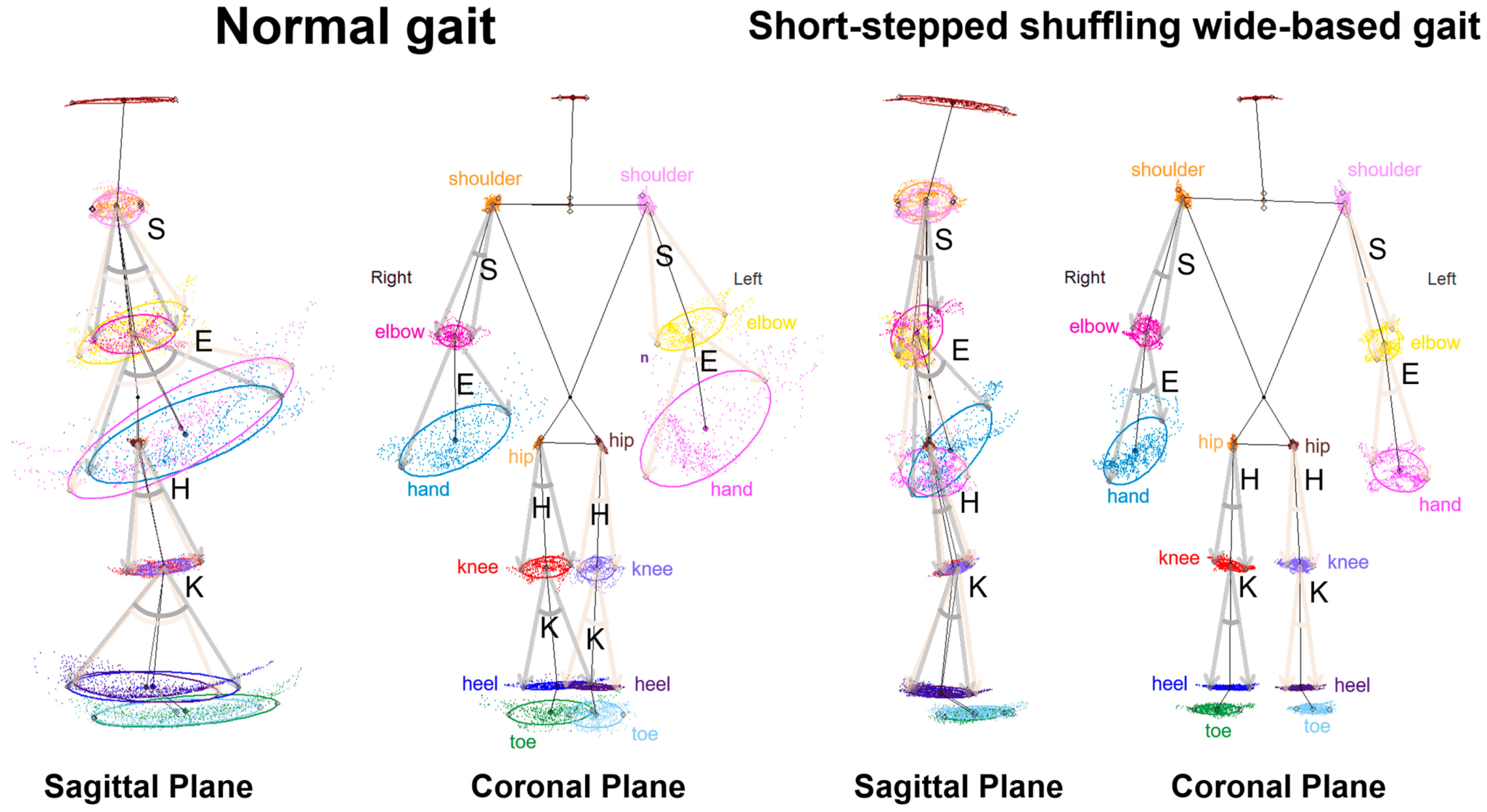 TDPTを使用し病的歩容の上下肢関節角度の変化を計測した論文が掲載されました | デジタルスタンダード公式
